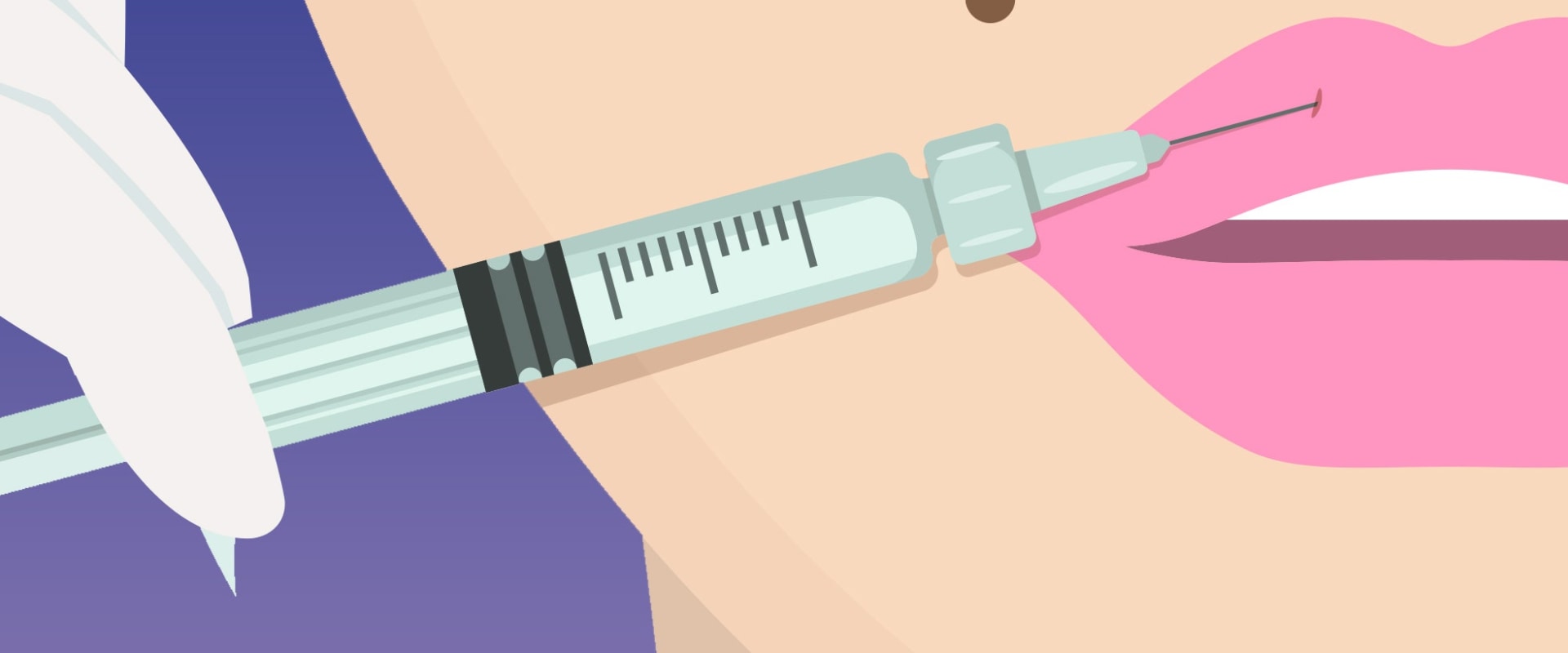 All You Need to Know About Syringe Injections for Lip Fillers